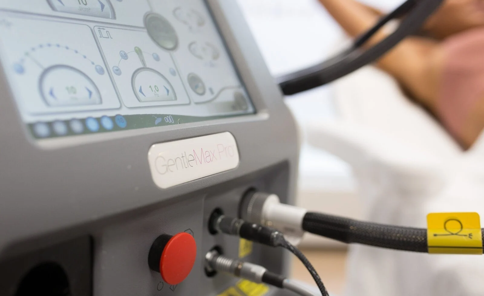 Gentlemax Pro Laser Hair Removal Machine - lufenlaser.com